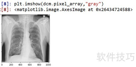 Python用pydicom读取DICOM文件_软件资讯技巧应用-中关村在线